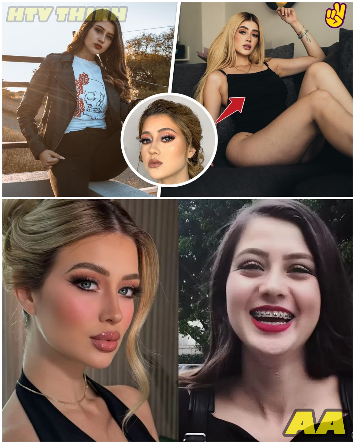 La Transformación de Valeria Márquez: Cirugías y la Búsqueda de la ...