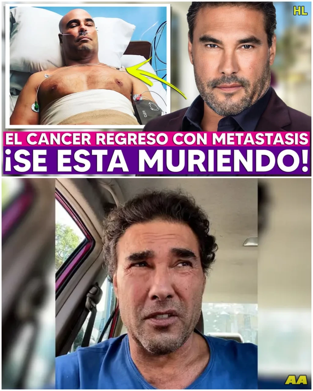 🚨 ¡La Verdadera Historia de Eduardo Yáñez! Su Batalla Contra el Cáncer ...